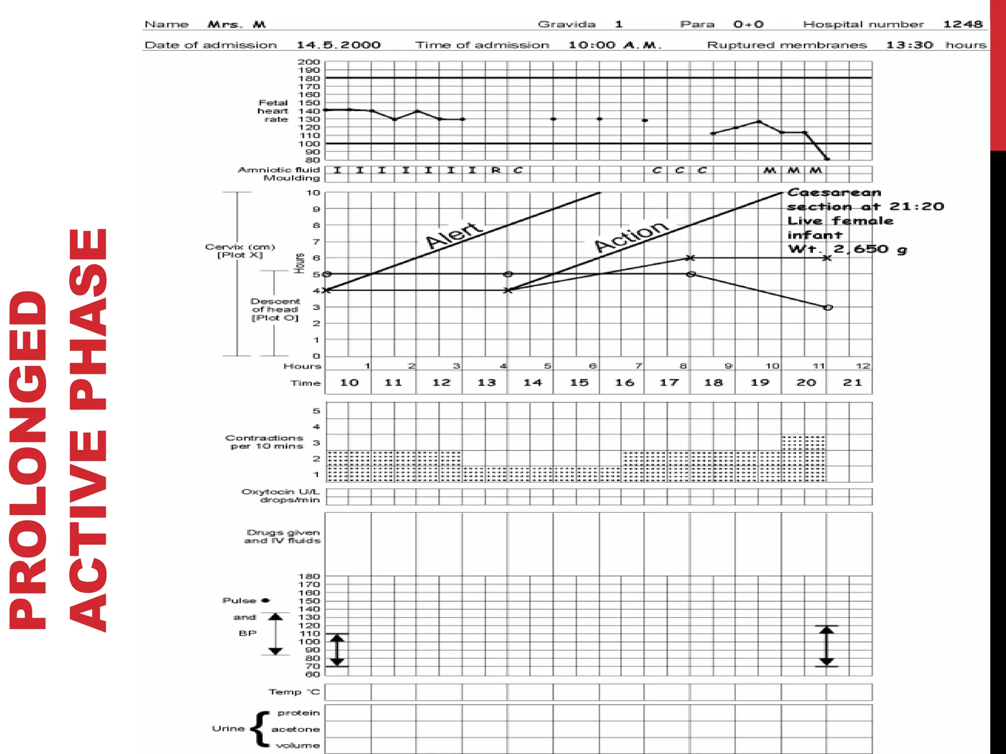 UNDERSTANDING THE PARTOGRAPH FOR LABOR MANAGEMENT | PDF