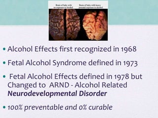 Understanding the spectrum of prenatal alcohol exposure part 2 | PPTX