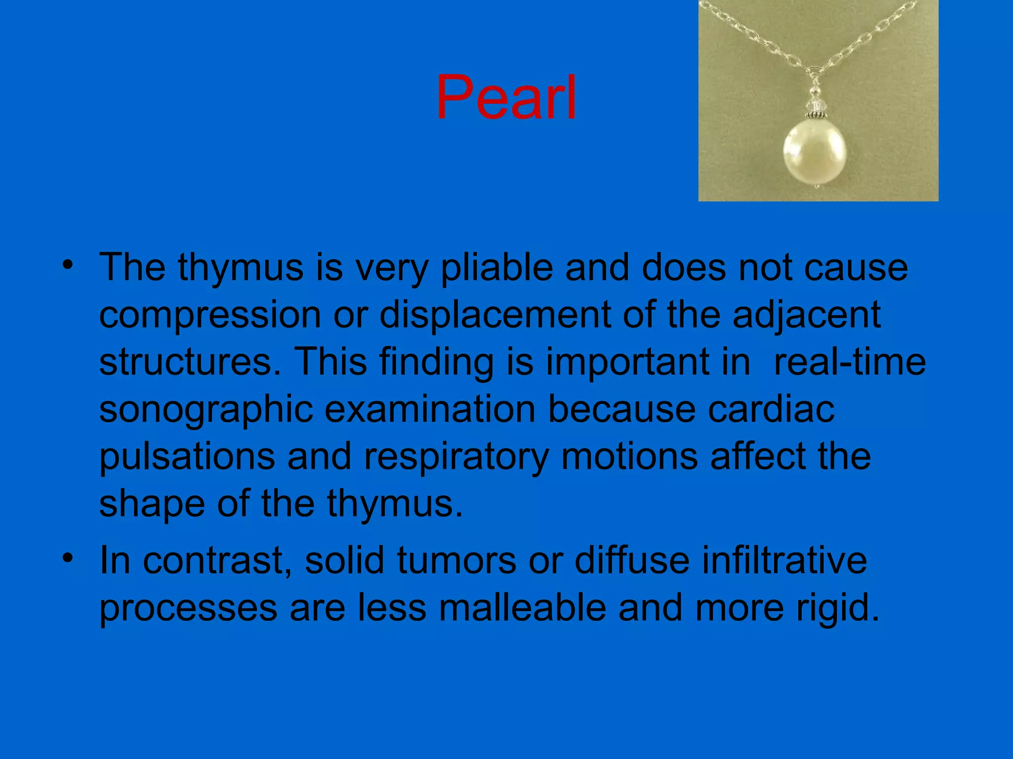 Understanding the thymus | PPT