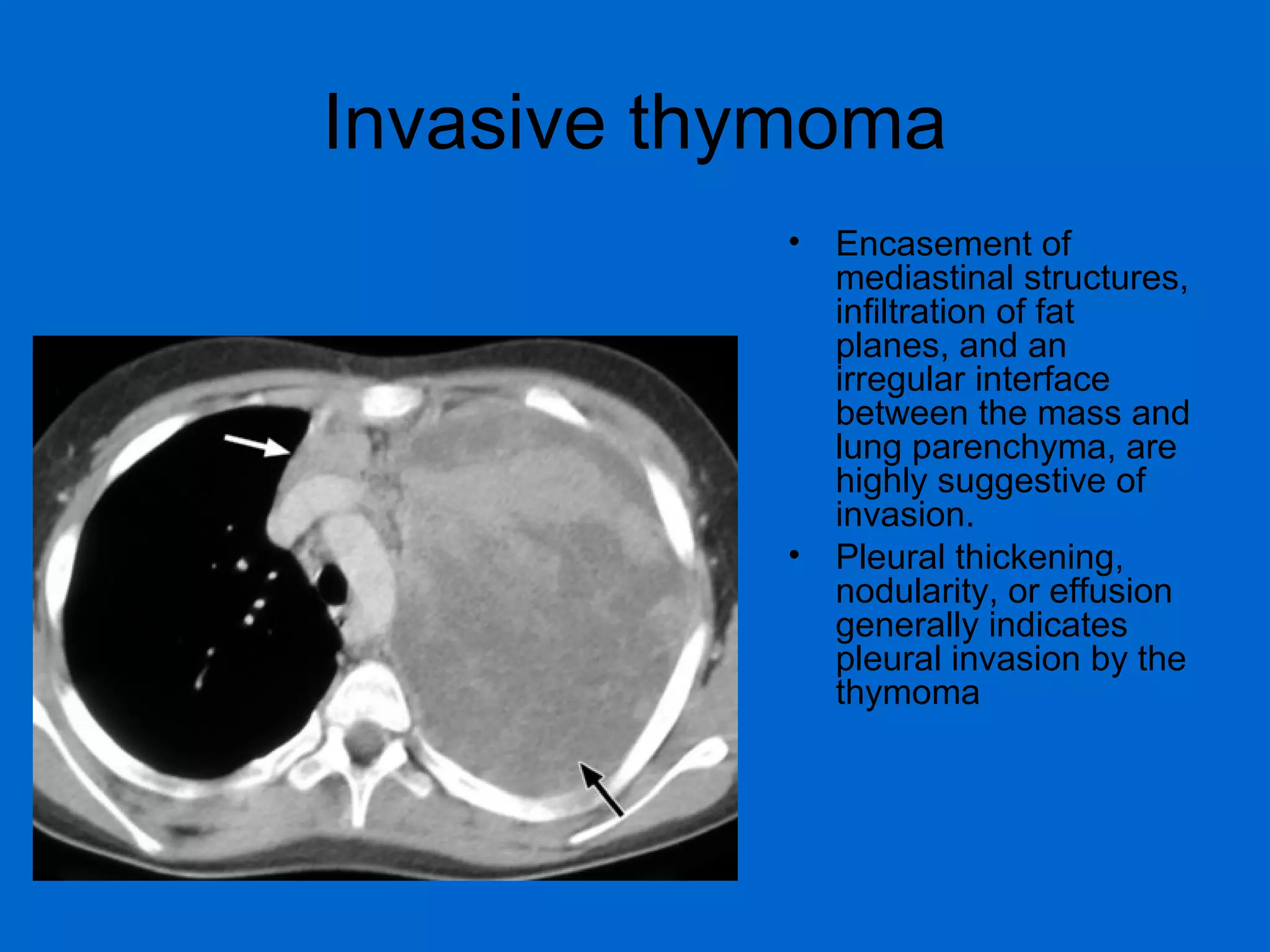 Understanding the thymus | PPT