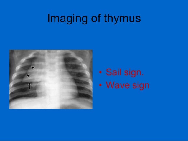 Understanding the thymus
