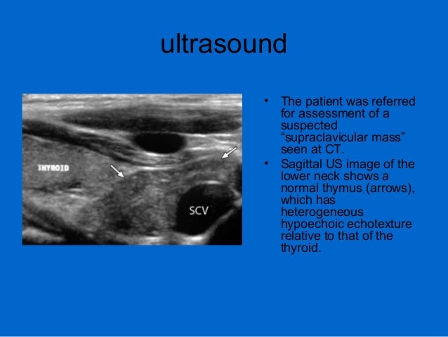 Understanding the thymus