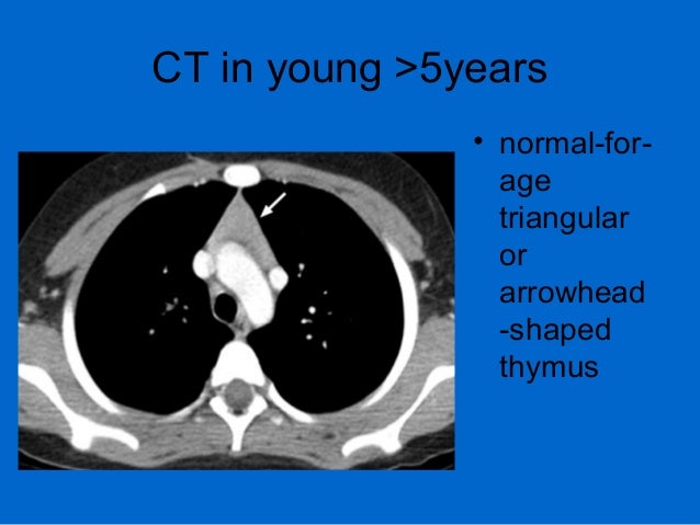 Understanding the thymus