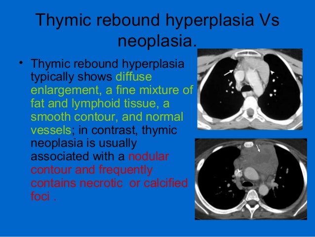 Understanding the thymus