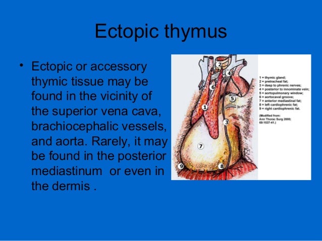 Understanding the thymus