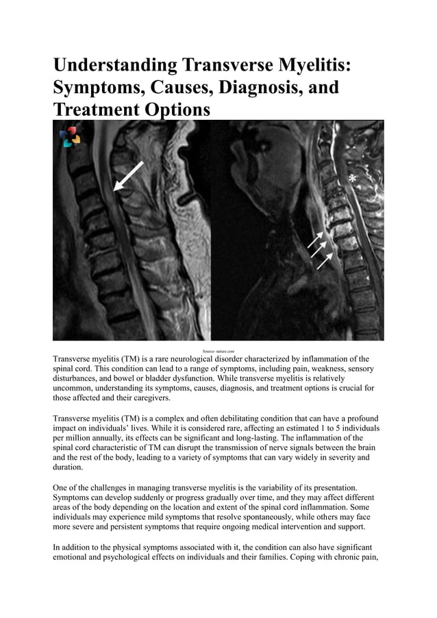Transverse Myelitis: Symptoms, Causes, Diagnosis, and Treatment Options ...