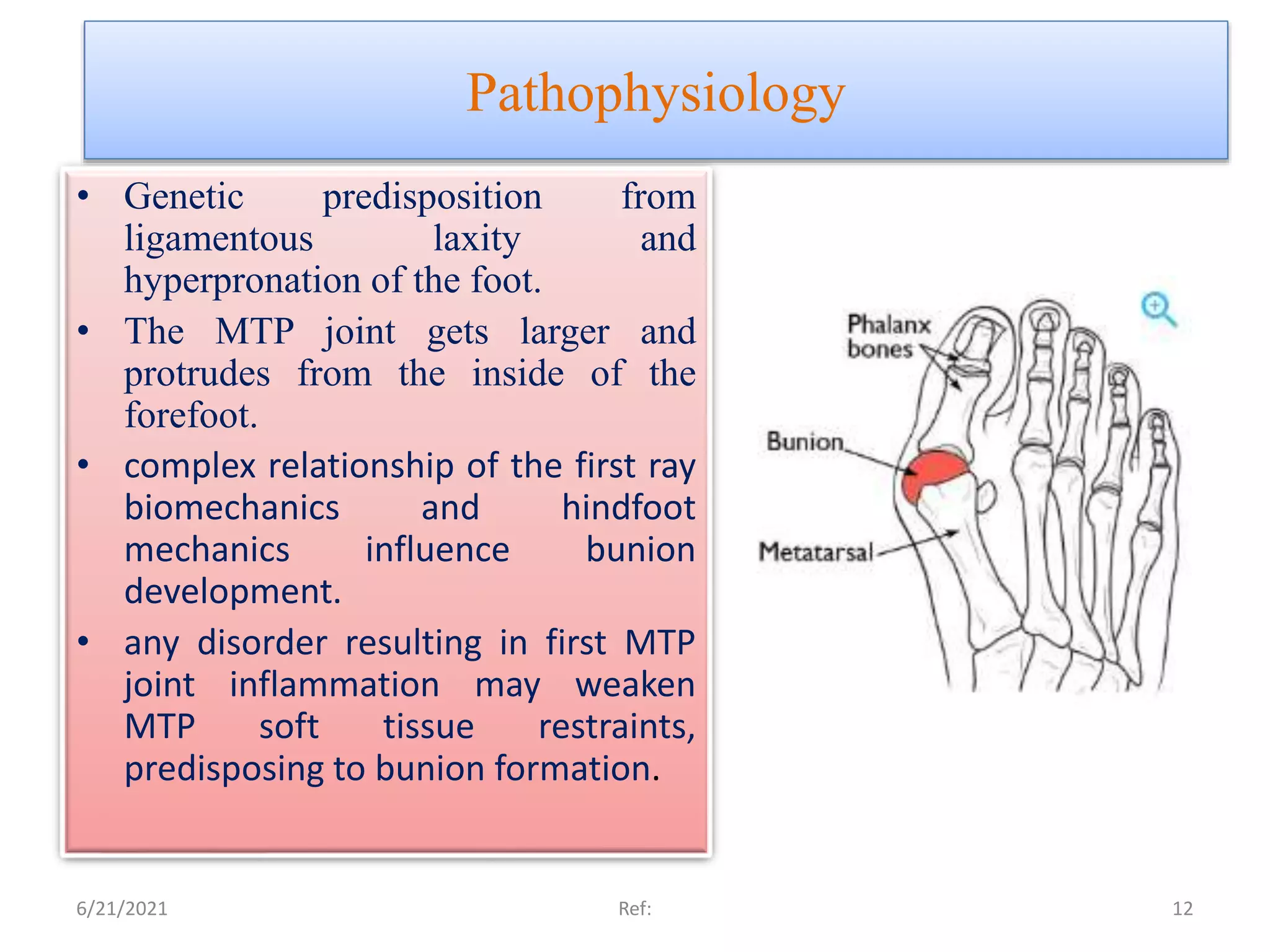 Understanding & treating common foot pathology | PPTX