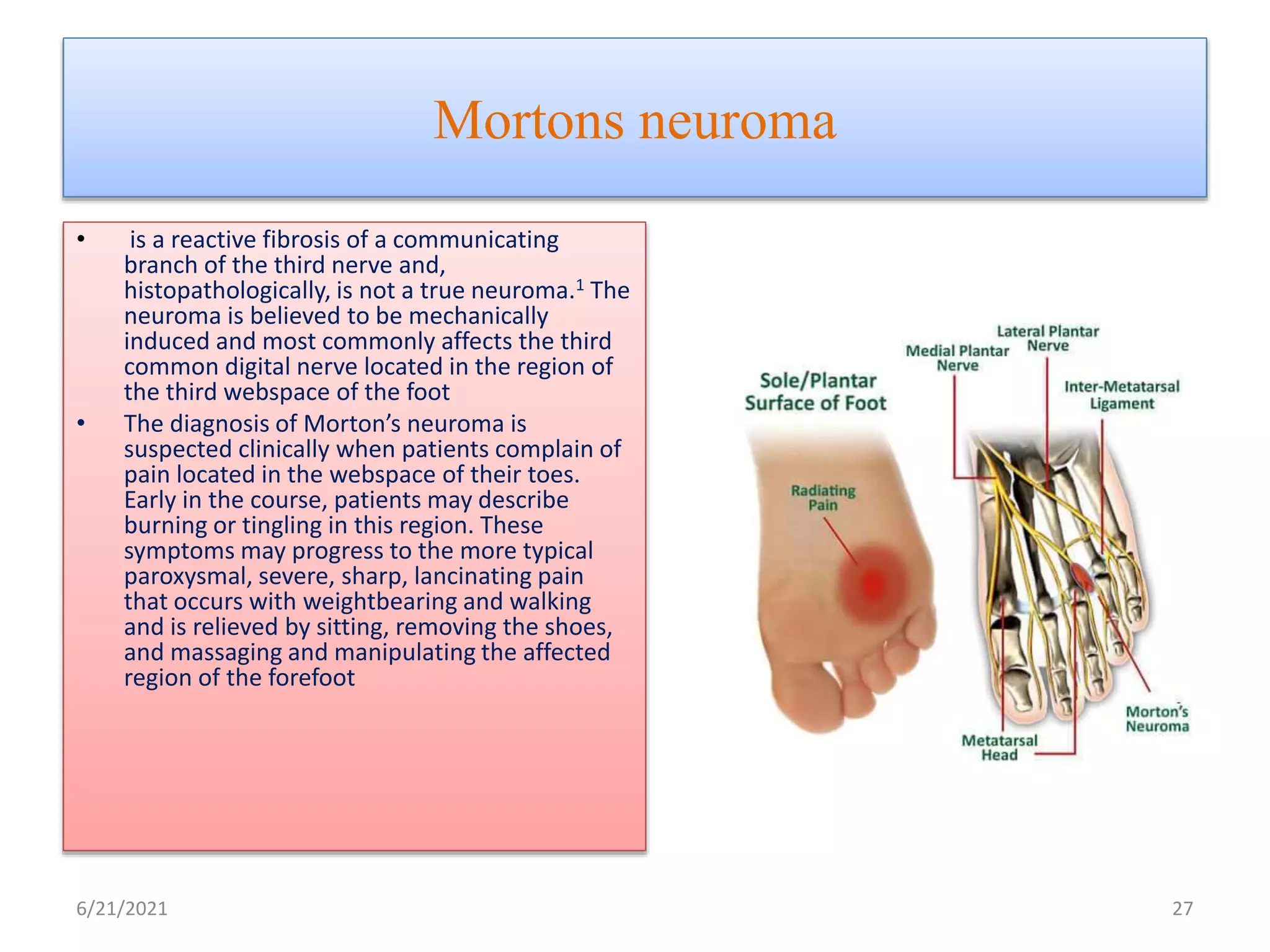 Understanding & treating common foot pathology | PPTX