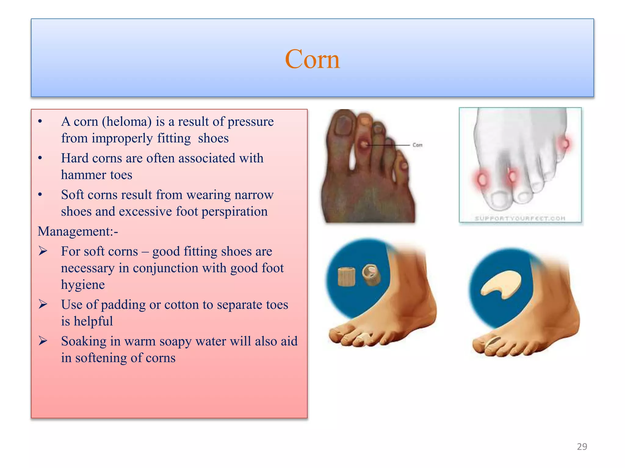 Understanding & treating common foot pathology | PPTX