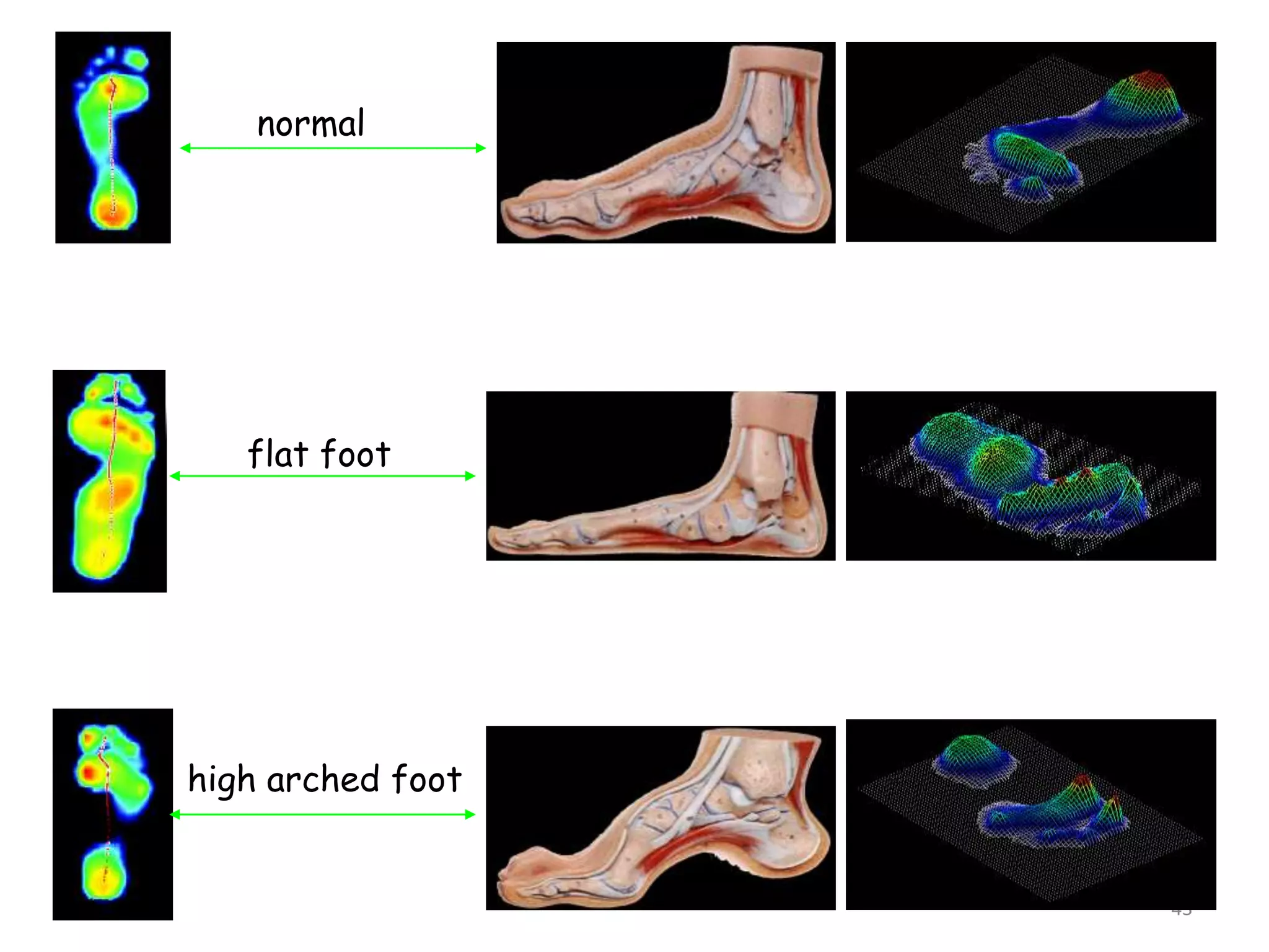 Understanding & treating common foot pathology | PPTX