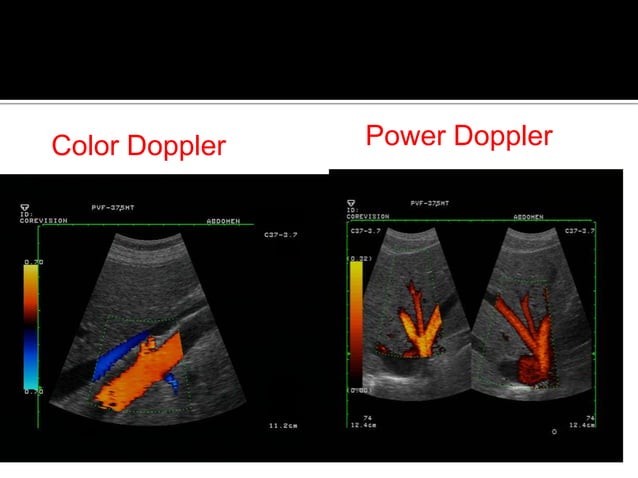 Understanding ultrasound | PPTX | Digital Audio | Computer Software and ...