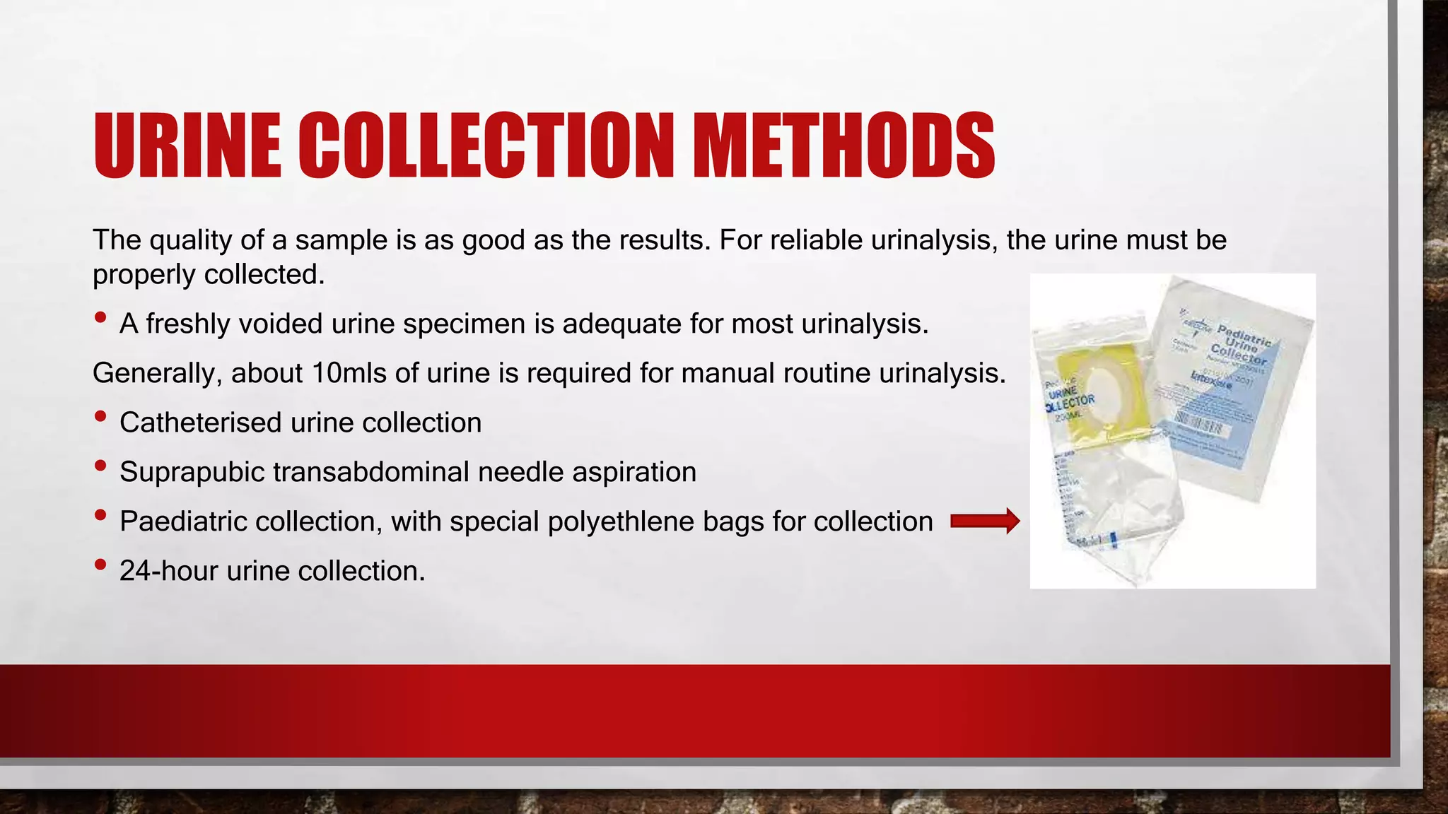UNDERSTANDING URINALYSIS.pptx | Endocrine and Metabolic Diseases | Diseases and Conditions