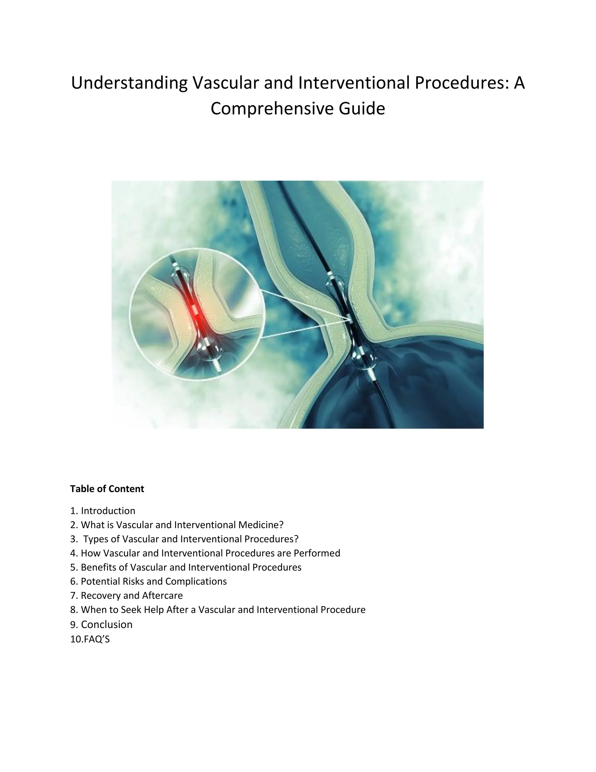 Understanding Vascular and Interventional Procedures: A Comprehensive ...