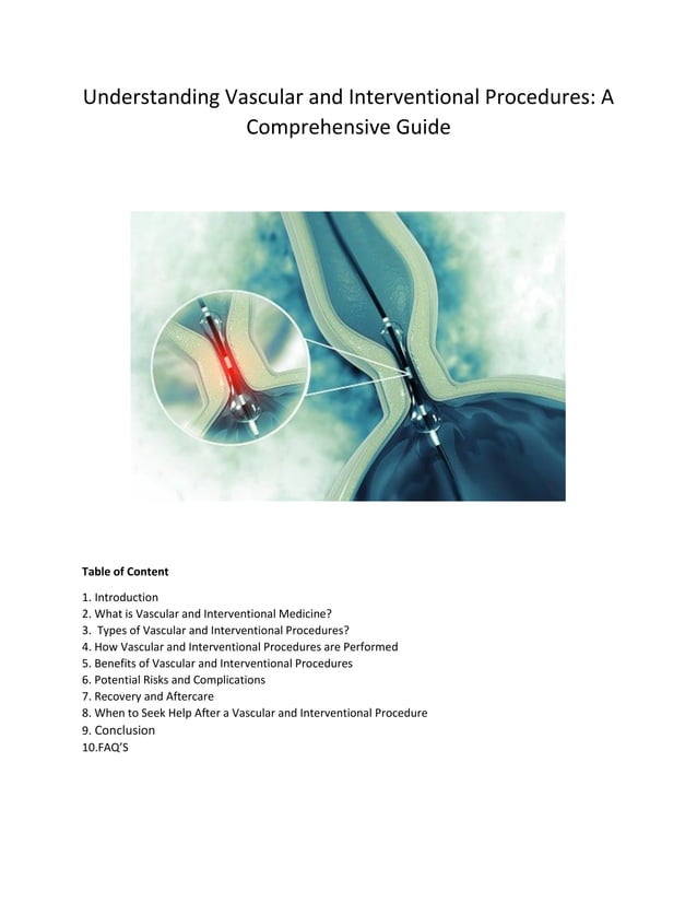 Understanding Vascular and Interventional Procedures: A Comprehensive Guide | PDF