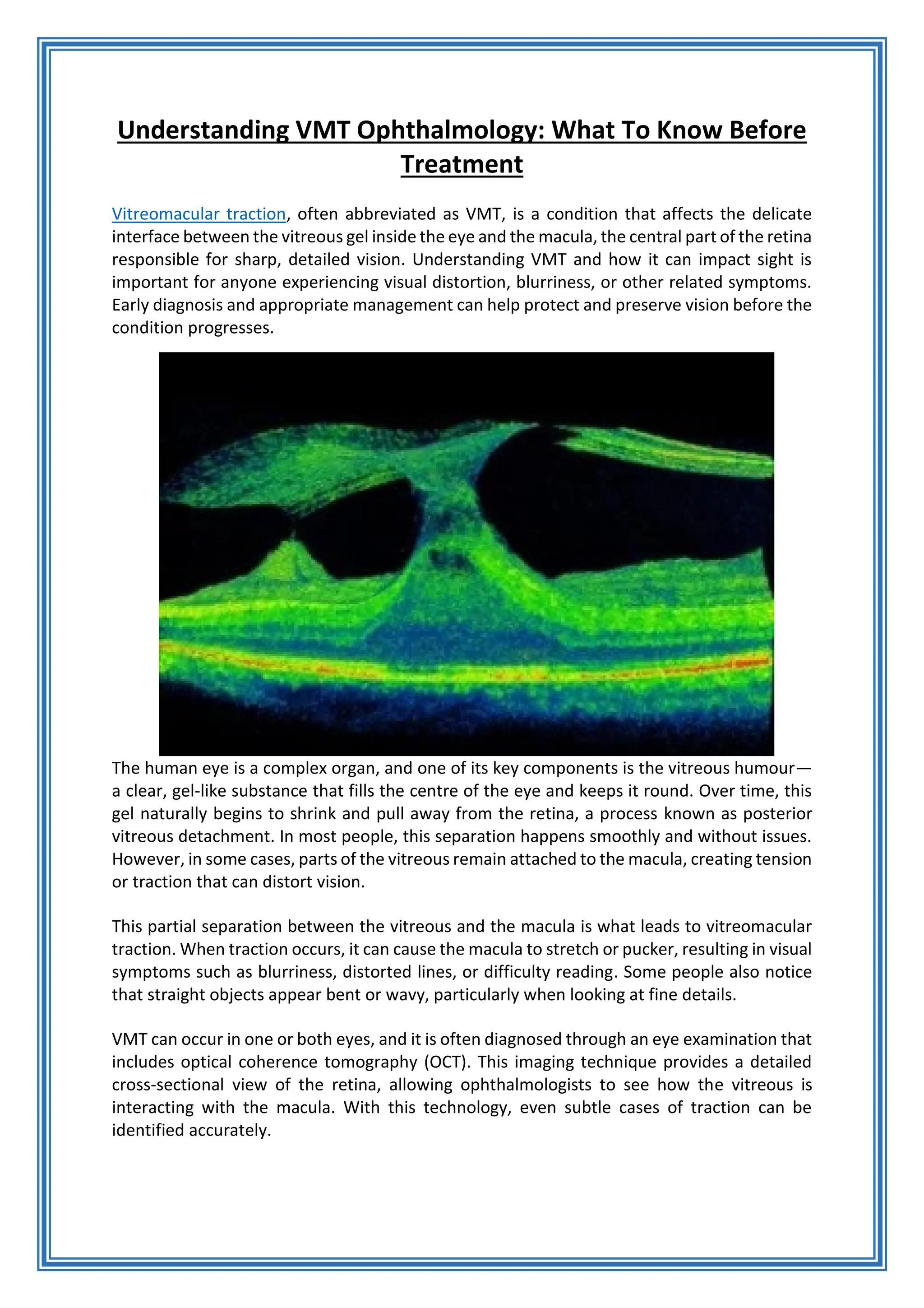 Understanding VMT Ophthalmology What To Know Before Treatment.pdf