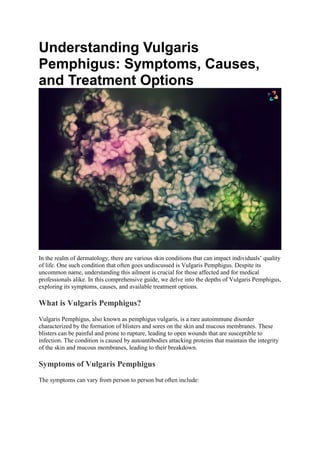 Vulgaris Pemphigus: Symptoms, Causes, and Treatment Options | The ...