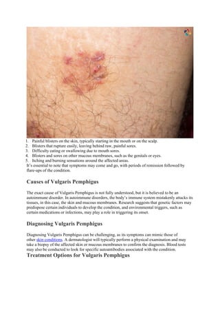 Vulgaris Pemphigus: Symptoms, Causes, and Treatment Options | The ...
