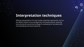 Understanding X Ray For Undergraduate Student Using Ai Pptx