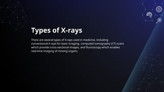 Understanding X-ray for undergraduate student using ai | PPT