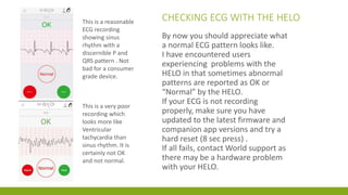 Understanding your heart health with your helo | PPT