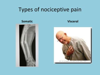 Understanding your pain | PPT