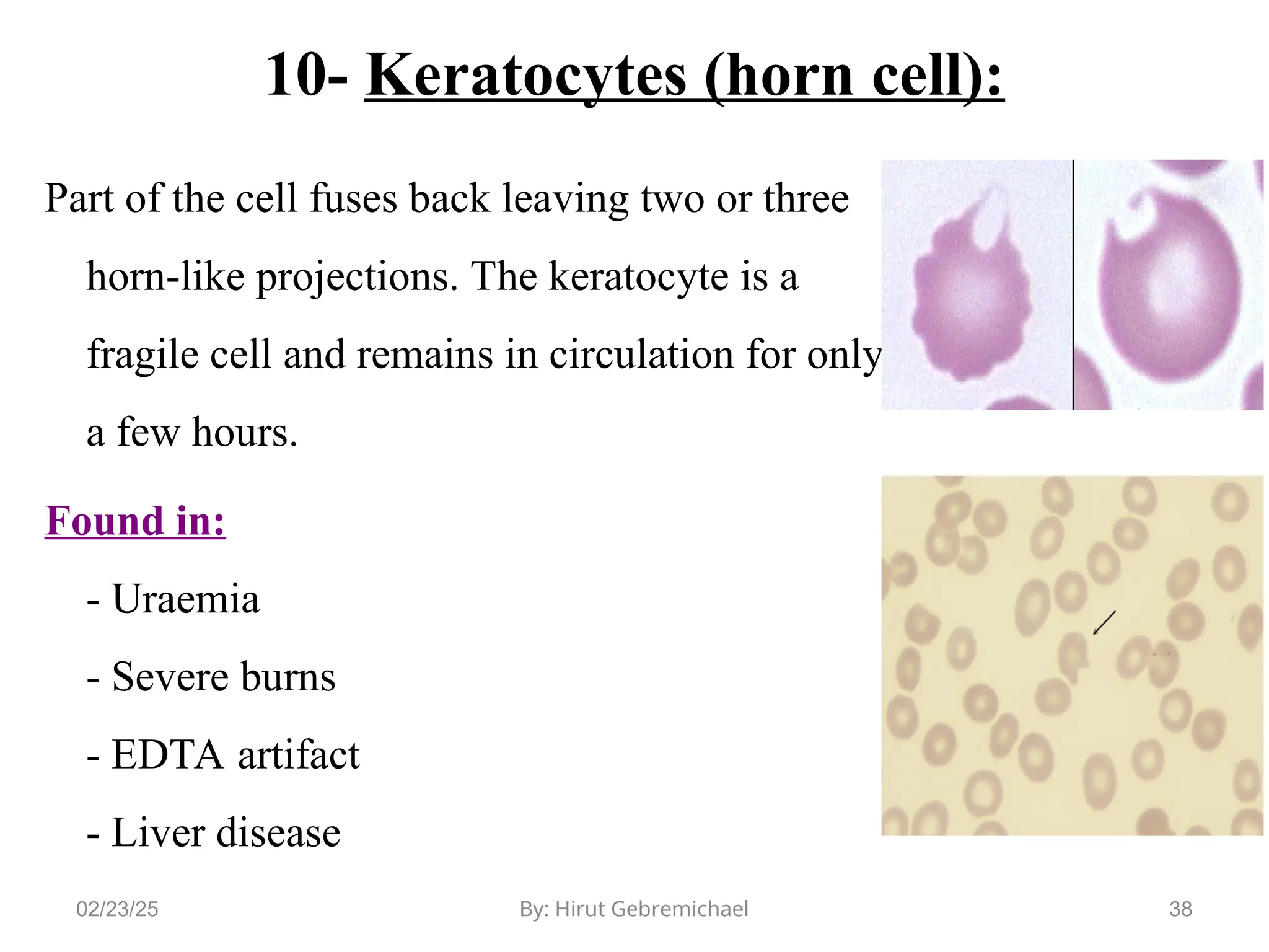 Understand RBCs morphology and inclusion bodies.ppt