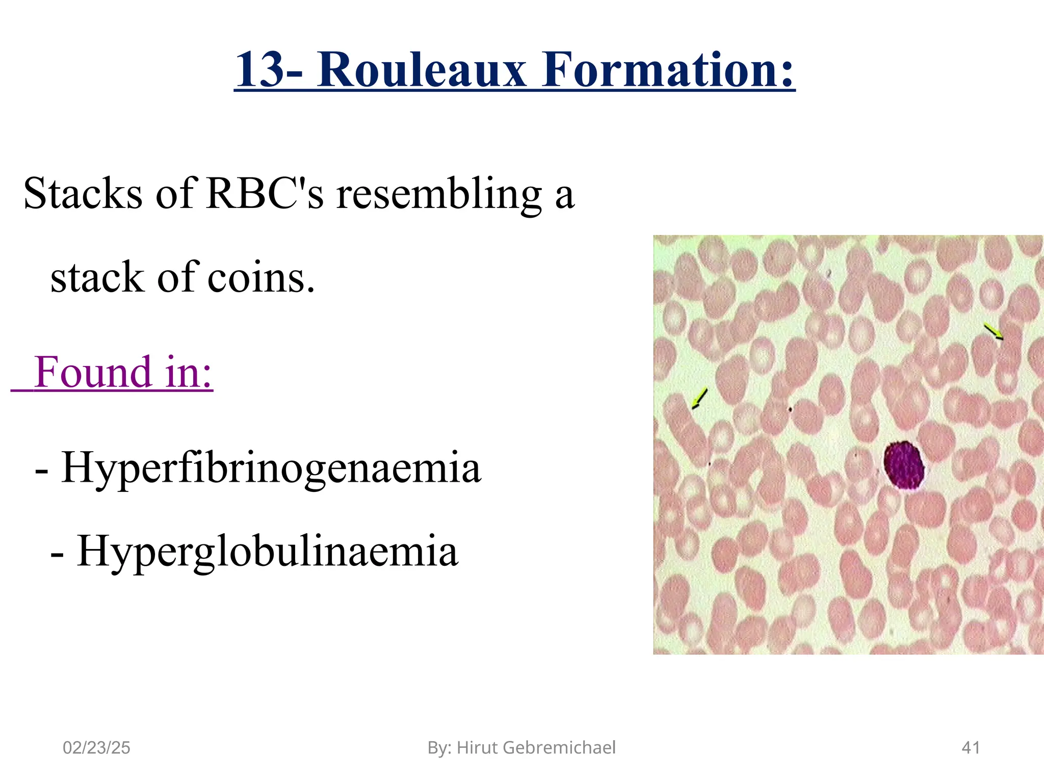Understand RBCs morphology and inclusion bodies.ppt