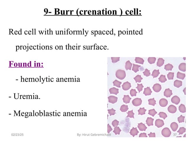 Understand RBCs morphology and inclusion bodies.ppt