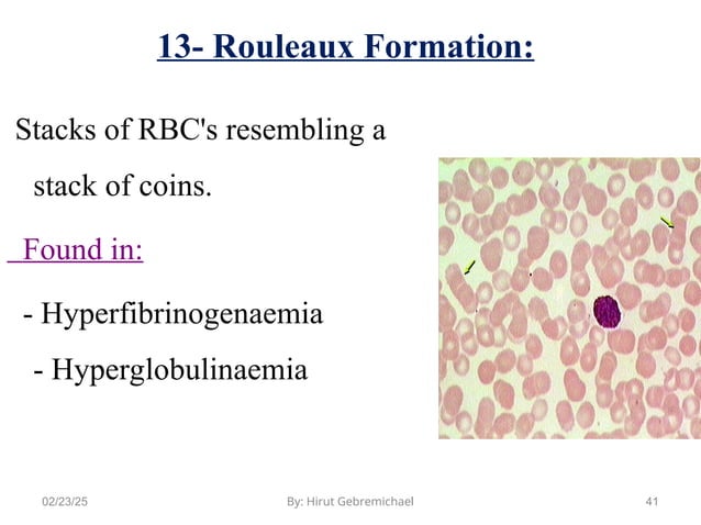 Understand RBCs morphology and inclusion bodies.ppt