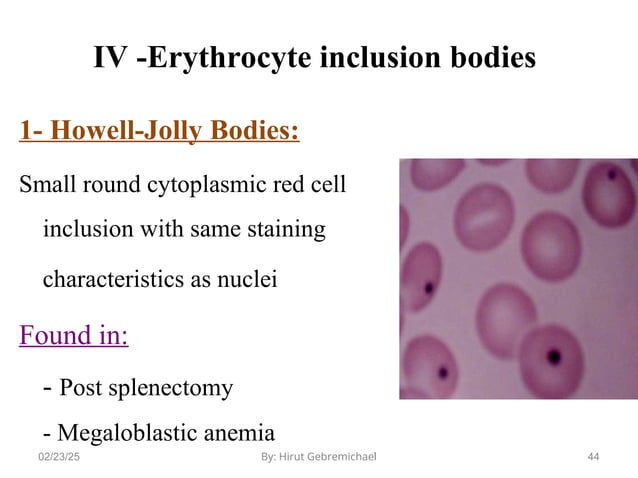Understand RBCs morphology and inclusion bodies.ppt