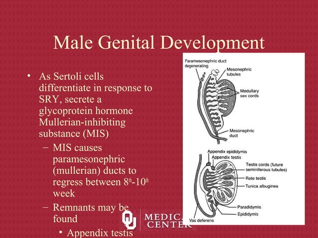 Undescended testicle | PPT
