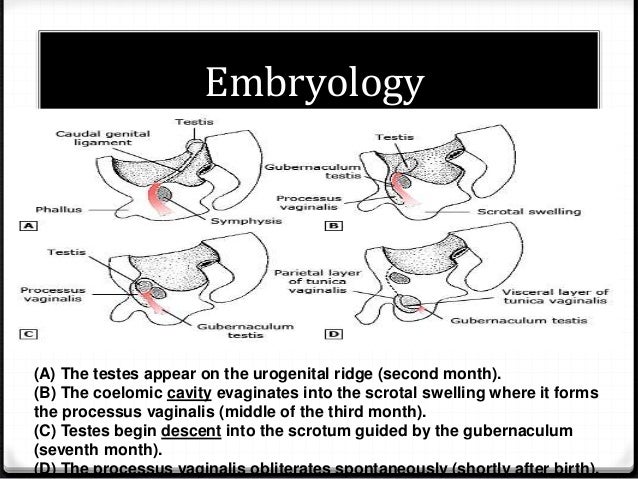 Undescended testes