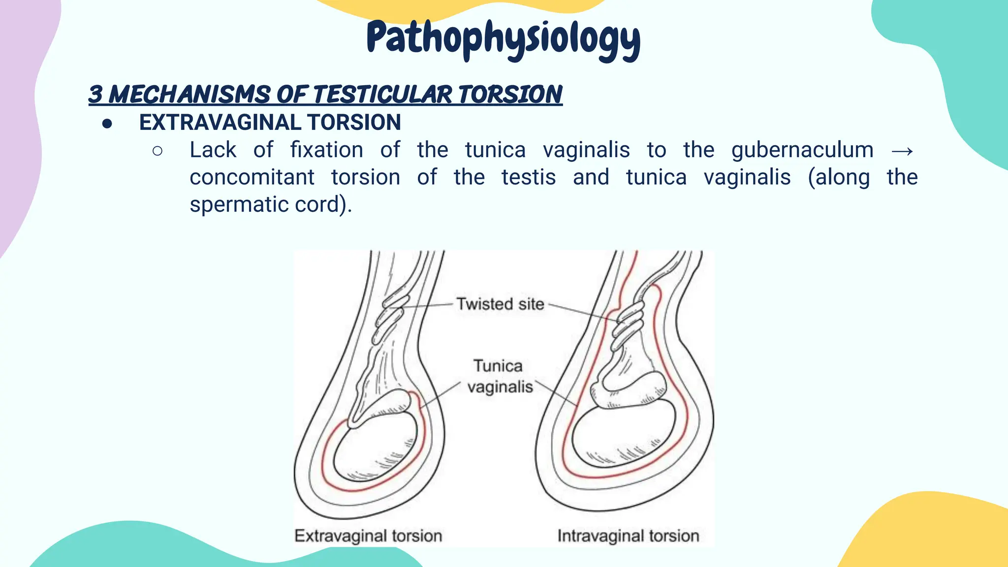 Undescended Testes Hydrocele Testicular Torsion Pdf