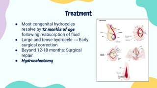 Undescended Testes, Hydrocele, Testicular Torsion.pdf