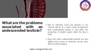 Undescended Testicles Causes – Undescended Testicles – BXEZAV