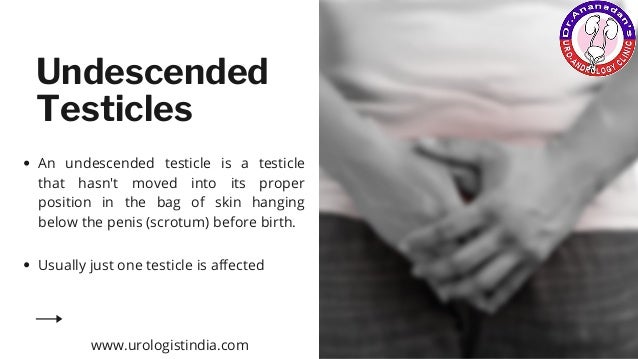 Undescended Testicle Symptoms And Causes