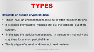 UNDESCENDED TESTIS/CRYPTORCHIDISM(CONGENITAL ANOMALY OF GENITOURINARY ...