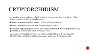 undescended testis.pptx