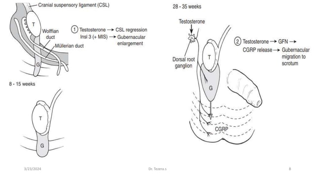 undescended testis and acute scrotum 2023.pptx