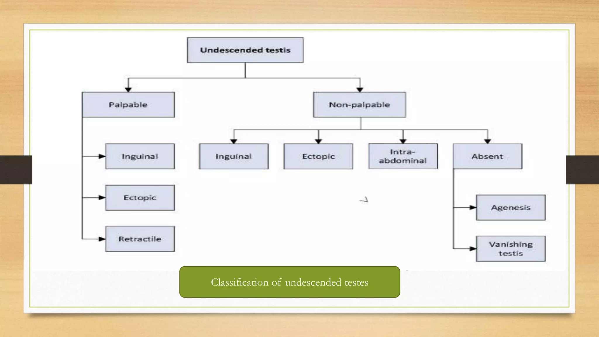 Undescended Testis (UDT) | PPTX
