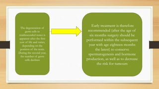 Undescended Testis (UDT) | PPTX