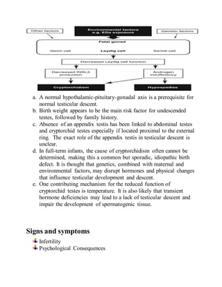 Undescended testtis | PDF