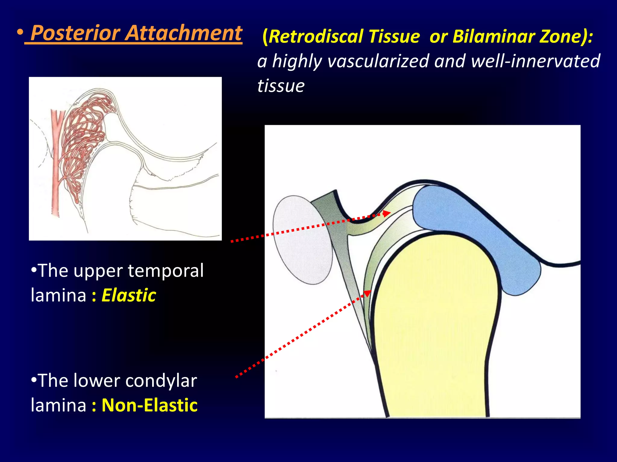 Undestanding tmj internal derangements 1 | PDF
