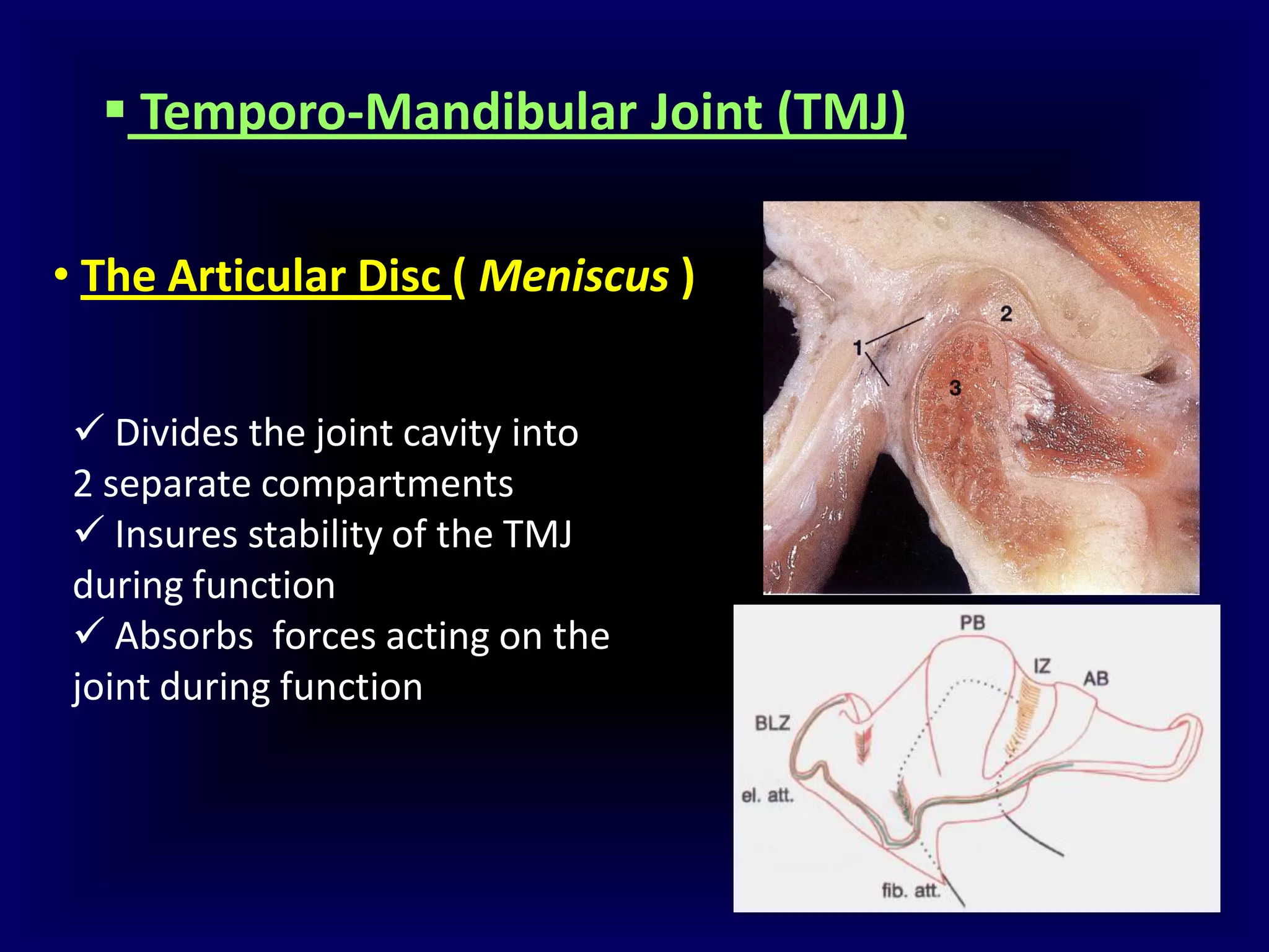Undestanding tmj internal derangements 1 | PDF