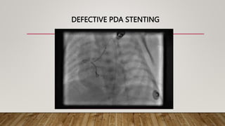 Unexpected Complication in The Cath Lab.pptx