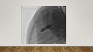 Unexpected Complication in The Cath Lab.pptx