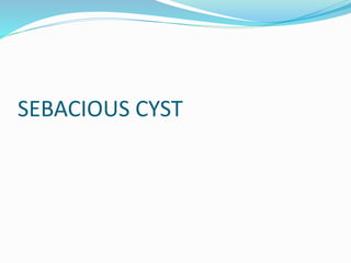 Unexplained lumps | PPTX