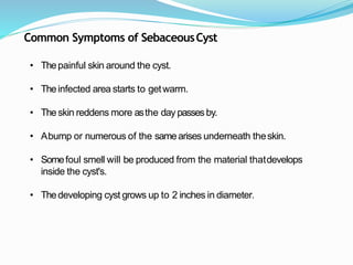 Unexplained lumps | PPTX