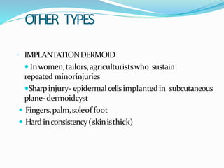 Unexplained lumps | PPTX