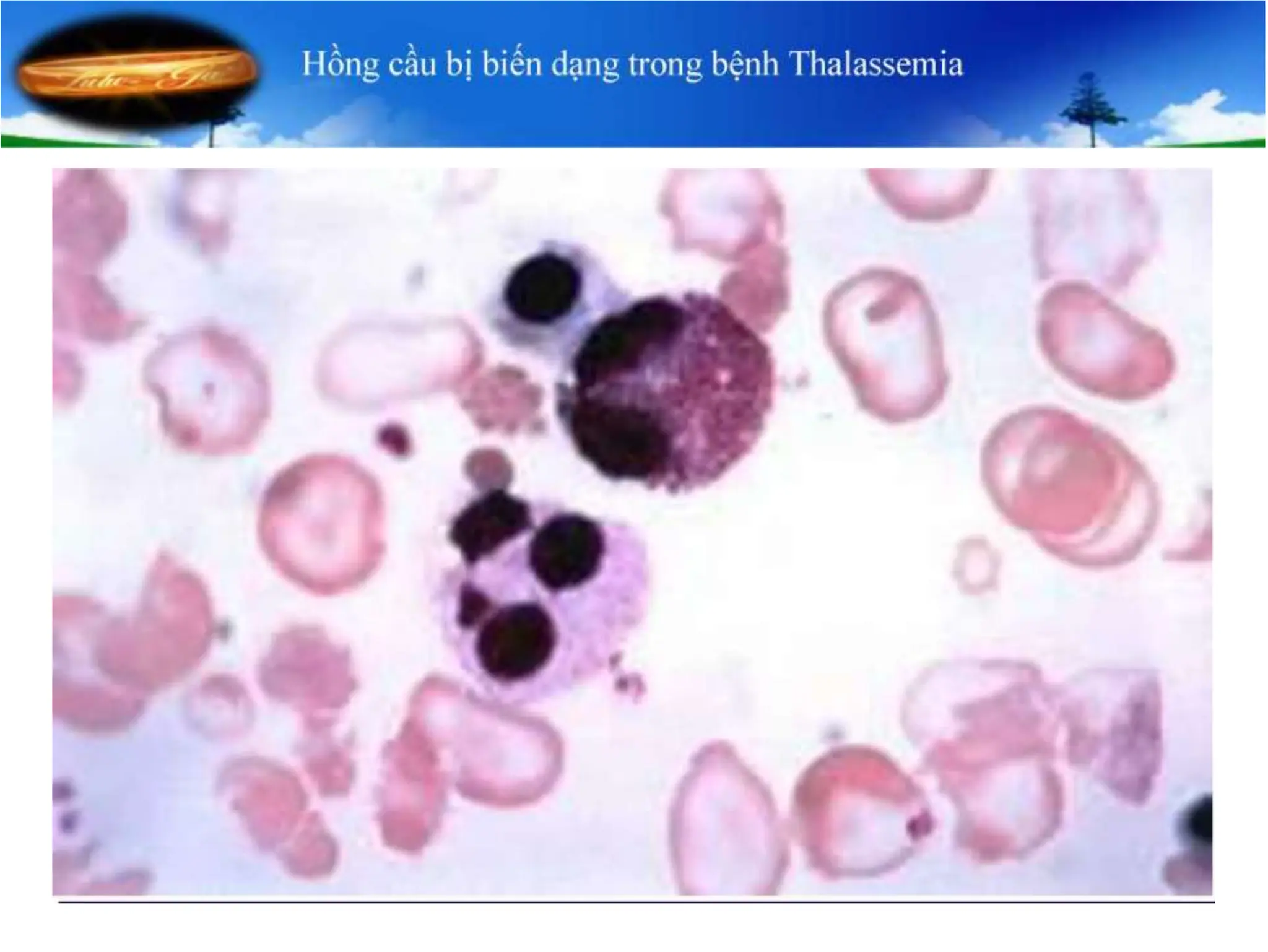Ung dung Sinh hoc phan tu trong y hoc hd | PPTX